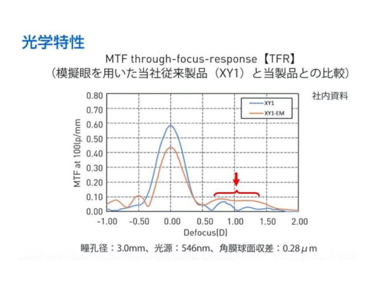 HOYA VIVINEX Impress (XY1-EM)先行使用のお知らせ | 諸星眼科クリニック｜西荻窪駅3分｜白内障手術 多焦点眼内レンズ ICL