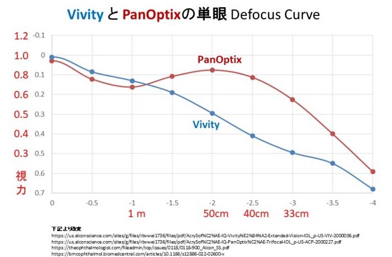 【白内障手術症例No.85】 杉並区50代男性 遠視眼 Mix-and-Match （左眼:パンオプティクス⇒右眼:Vivity:ビビティ ...